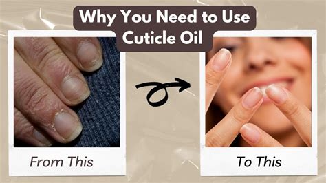 What Are The Benefits Of Using Cuticle Oil The Product Guide