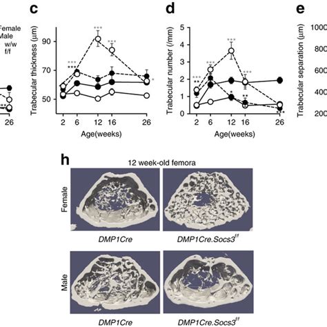 Sex Hormone Treatment Protects Against Gonadectomy Induced Trabecular