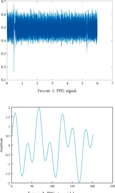 Figure 1 From Detection Of Cardiovascular Disease Based On Ppg Signals Using Machine Learning