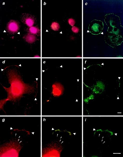Endogenous Layilin Is In Membrane Ruffles Cells Are Shown Stained With