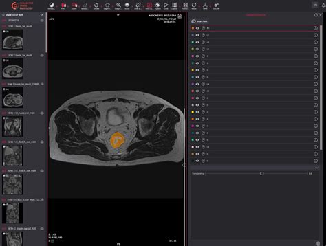 dicom rtstruct essential standard for radiotherapy and medical image