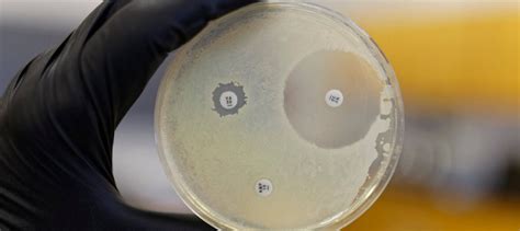 Zoi Testing The Importance Of Environmental Factors