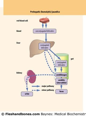 Bilirubin Pathology Flashcards Quizlet