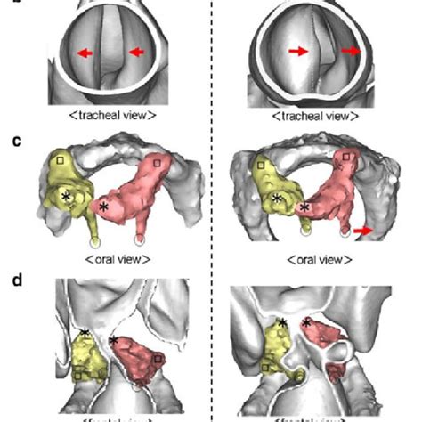 Mediocranial Ad Yellow Coloration Healthy Arytenoid Red Coloration