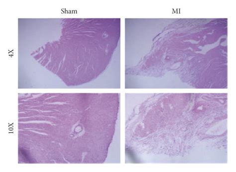 Effects Of Drugs On Quantification Of Myocardial Infarct Size And Download Scientific Diagram