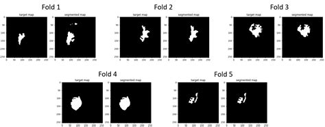 GitHub Ksoh Brain Tumor Segmentation Mini Project Using The TensorFlow And PyTorch