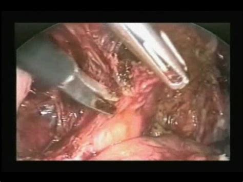 Obstetrics Gynecology