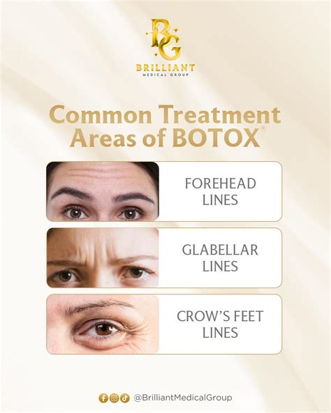 Brilliant Medical Group Did You Know Botox Is Effective In Treating Specific Areas Such As