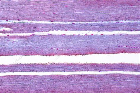 Human Skeletal Muscle Light Micrograph Stock Image F032 4136 Science Photo Library