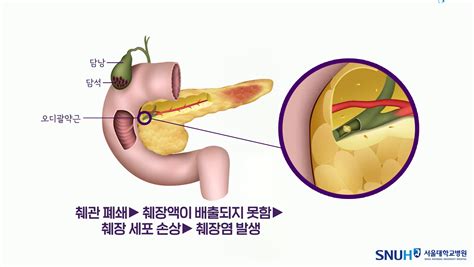 서울대학교병원
