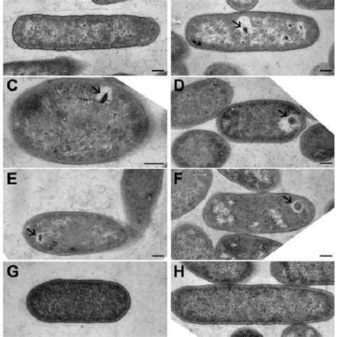 A Anti Gfp Immunogold Tem Of A Thin Section Of E Coli Jm109 Cells