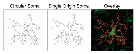 Quantifying Microglia Morphology From Photomicrographs Of Immunohistochemistry Prepared Tissue