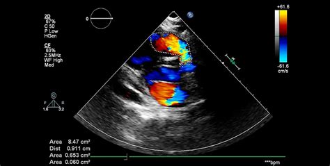Advanced Colour Doppler Ultrasound In Sharjah Al Safwa Radiology Center