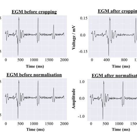 Data Augmentation A The Effect Of Random Cropping With A Window