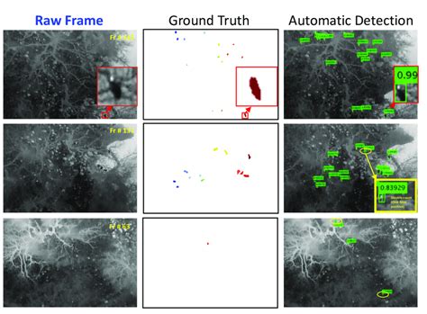 Three Examples That Show Three Cases For Our Automatic Detection For Download Scientific