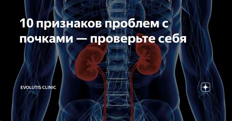 10 признаков проблем с почками — проверьте себя Evolutis Clinic Дзен