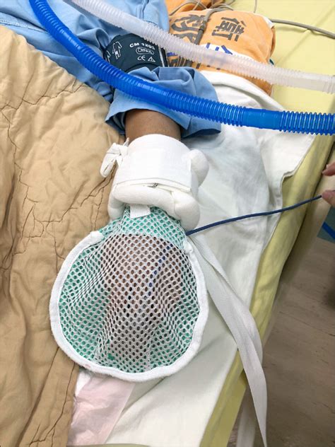 護病也護己 護理師綁病患有原因 自由健康網