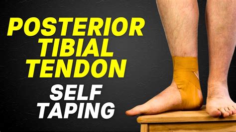 Posterior Tibial Tendonitis Taping Posterior Tibial Tendon Dysfunction Taping Youtube