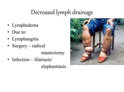 Lymph Definition Formation And Factors Affecting Lymph Flow Including