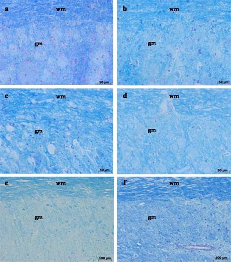 Reduced Loss Of Myelin Structure In Sci Gitr And Sci Gitr Mice Download Scientific Diagram
