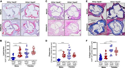 Sex Specific Differences In Lesion Lipid Burden Plaque Area And Download Scientific Diagram
