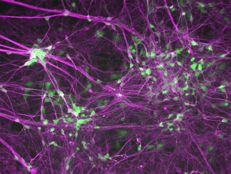 Human Induced Motor Neurons [image] Eurekalert Science News Releases