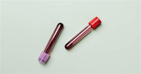 Eritrociti I Hemoglobin Što Kada Su Povišeni Ili Sniženi