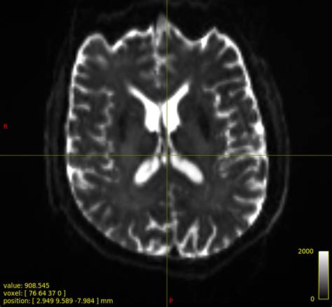 Dwinormalise Output File Error Mrtrix3 Community