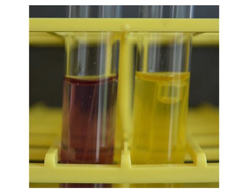 Lactose Fermentation Test — Printable Worksheet