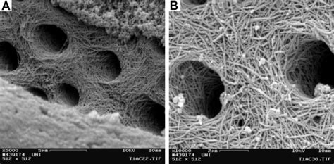 The Banding Pattern Was Clearly Visible At The Collagen Fibers When The Download Scientific