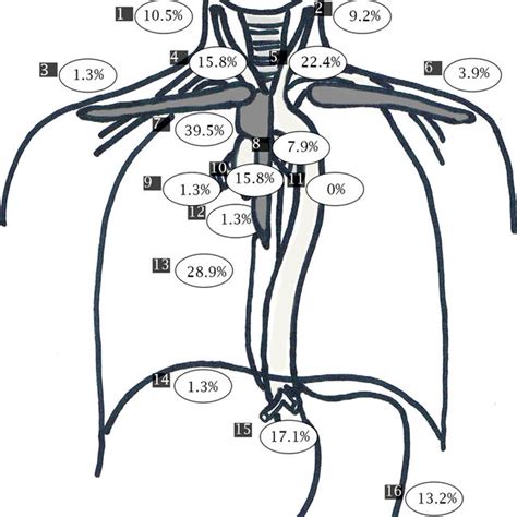Pattern Of Lymph Node Metastases 1 Right Cervical 2 Left Cervical