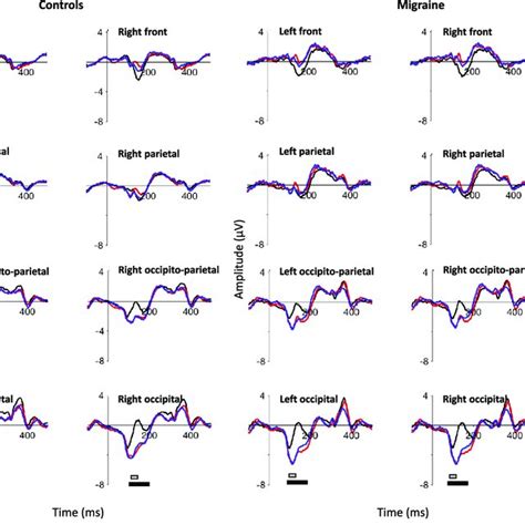 Waveforms To The Blue Green Red Blue And Red Green Color Pairs For