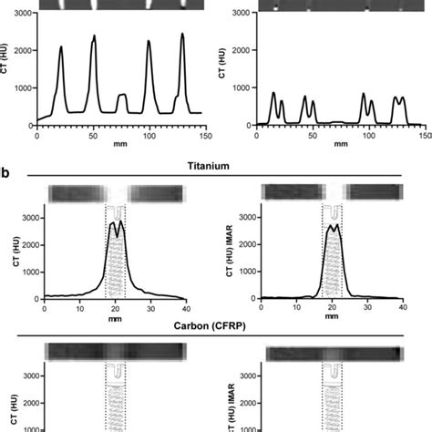 CT Measurements A Sagittal Overview And Measurement Of The Whole Download Scientific Diagram