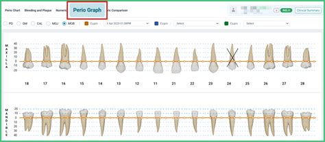 Description Of Gum Measurements For Periodontal Charting Carestack