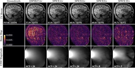 Figure 1 From Spice Self Supervised Learning For Mri With Automatic Coil Sensitivity Estimation