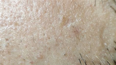 How To Prevent Ingrown Hairs After Shaving Face Shaven Theory