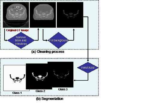 pre processing of the ct data to remove irrelevant elemtents from the