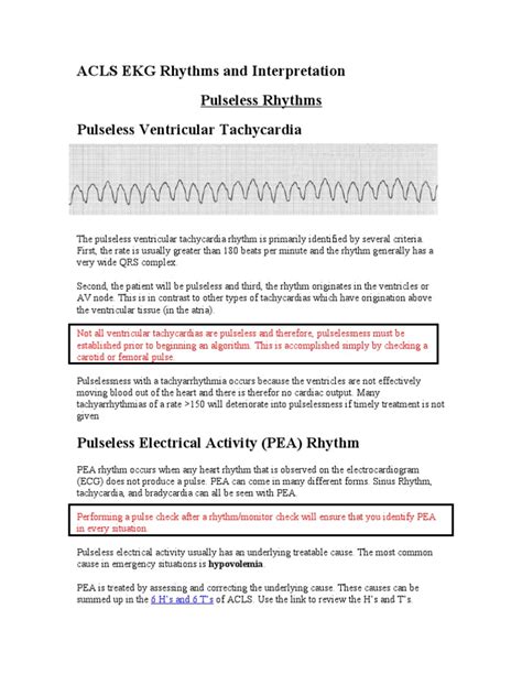 Acls Ekg Rhythms And Interpretation Cardiac Arrhythmia Heart