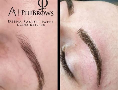 Patch Testing What Is It Why Is It Important The Beauty Spot