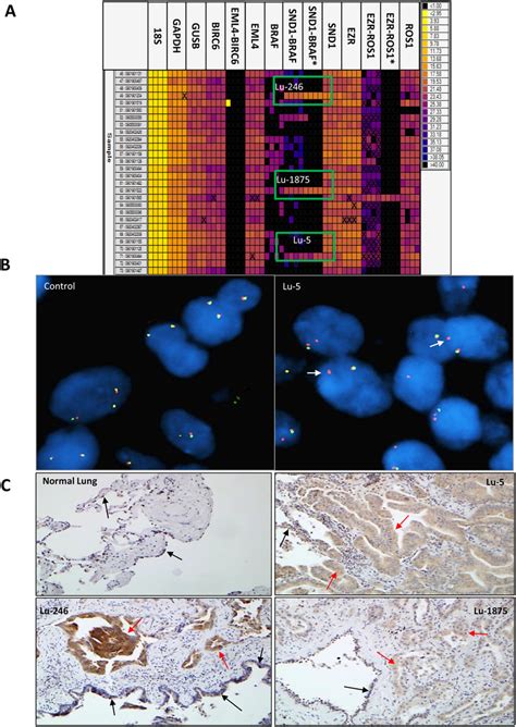 Validation And Identification Of Additional Snd1 Braf Fusions In Lung