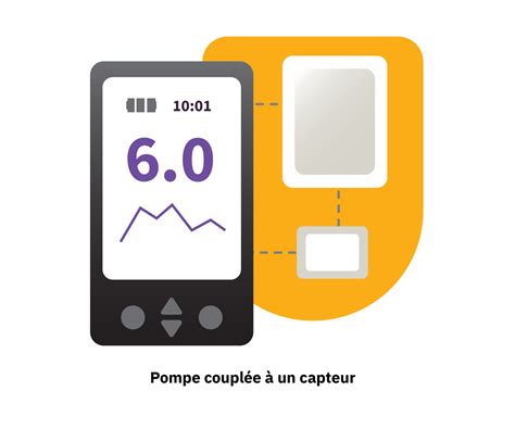 Thérapie Par Pompe à Insuline Simplifiée En Savoir Plus