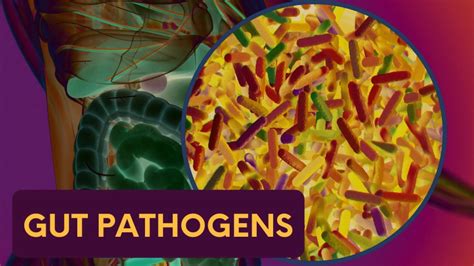 Gut Pathogens Triggers And How To Heal Bag Gut Bacteria