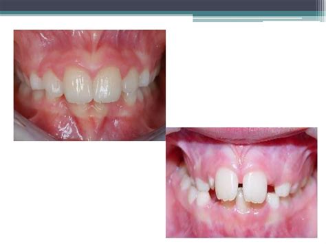 Self Correcting Anomalies Pptx