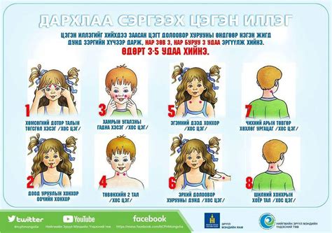 Томуу томуу төст өвчнөөс урьдчилан сэргийлэх зөвлөмж News Mn