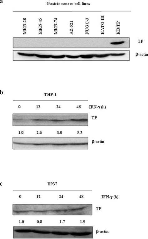 Expression Levels Of Tp In 6 Human Gastric Cancer Cell Lines A And 2