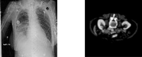 Secure Medical Image Authentication Using Zero Watermarking Based On Deep Learning Context Encoder