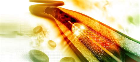 Българско национално дружество по съдова и ендоваскуларна хирургия и ангиология