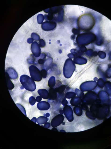 무료 이미지 식물 과일 자 꽃잎 유리 식품 생기게 하다 생물학 푸른 원 세포 매크로 사진 현미경 녹말 짙은 청록색 아밀로포체 류코 플라 스트