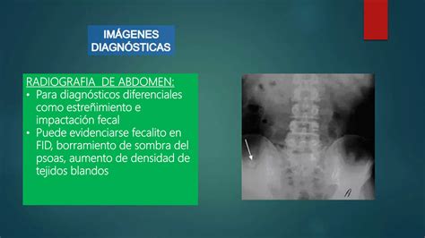 Sindrome Doloroso Abdominalpptx
