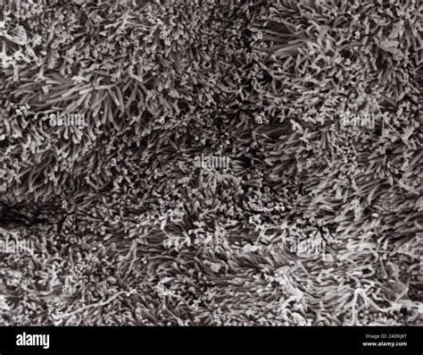 Tracheal Epithelium Scanning Electron Micrograph Sem Of The Internal